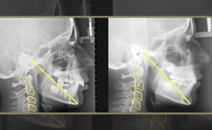 Functional Jaw Orthopedics