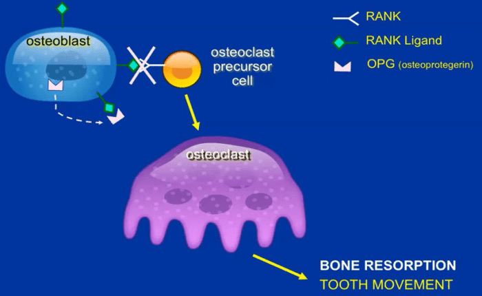 Tooth Movement